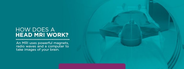 What to Expect in an MRI for the Head and the Brain | Envision Radiology