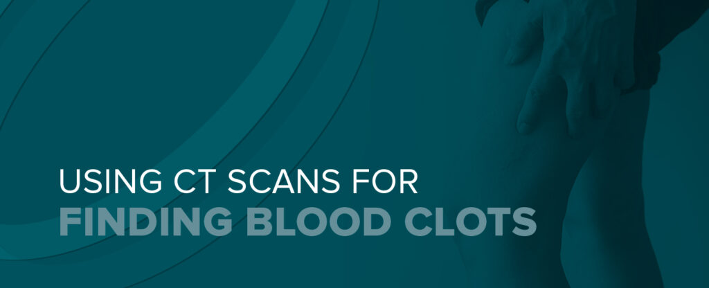 Using CT Scans for Finding Blood Clots | Envision Radiology
