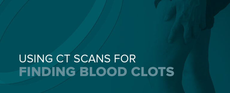 Using CT Scans for Finding Blood Clots | Envision Radiology