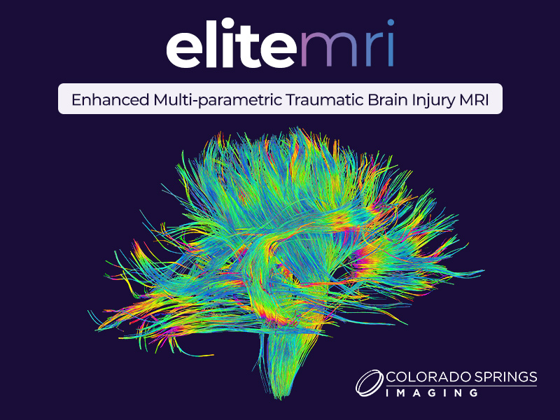 Elite MRI | Envision Radiology