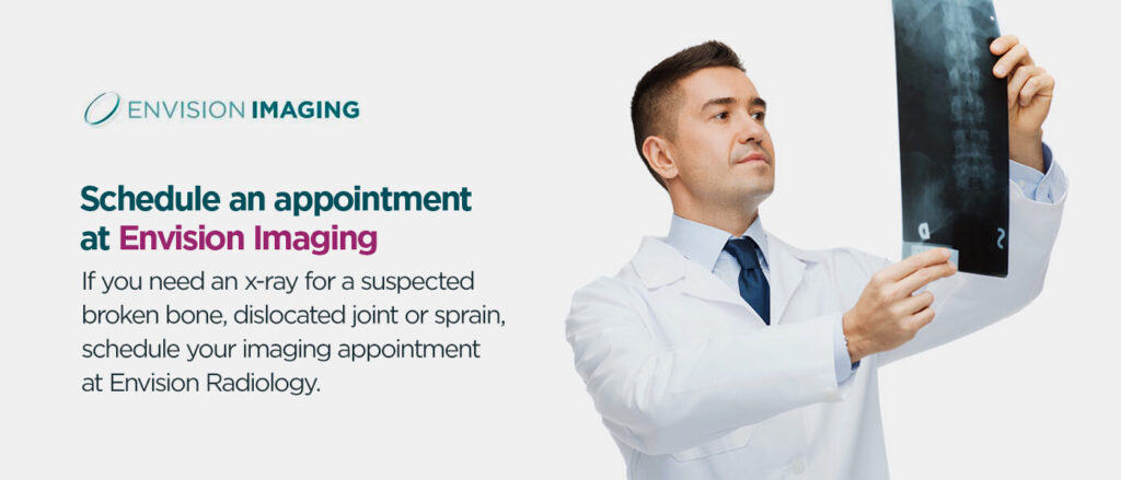 How to tell if you need an x-ray - Envision Radiology
