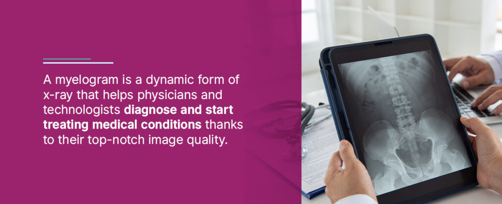 MRI vs. Myelogram - Envision Radiology