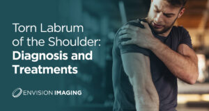 Torn Labrum of the Shoulder: Diagnosis and Treatments - Envision Radiology