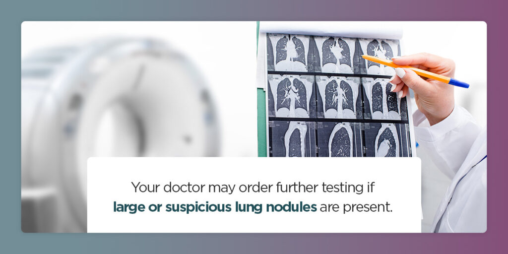 Low-dose CT lung cancer screening - Envision Radiology