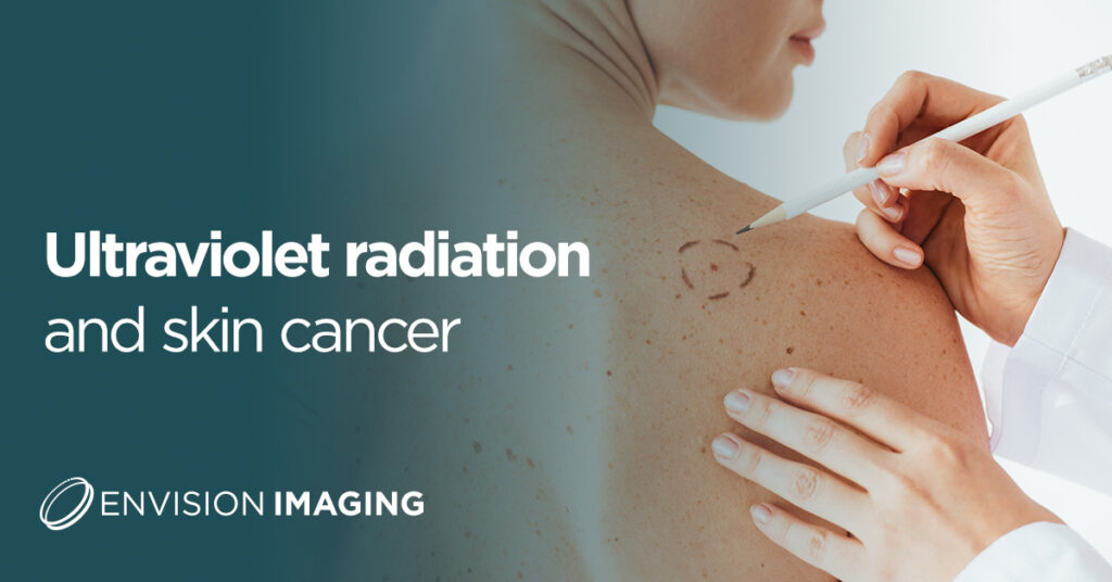 Ultraviolet radiation and skin cancer - Envision Radiology